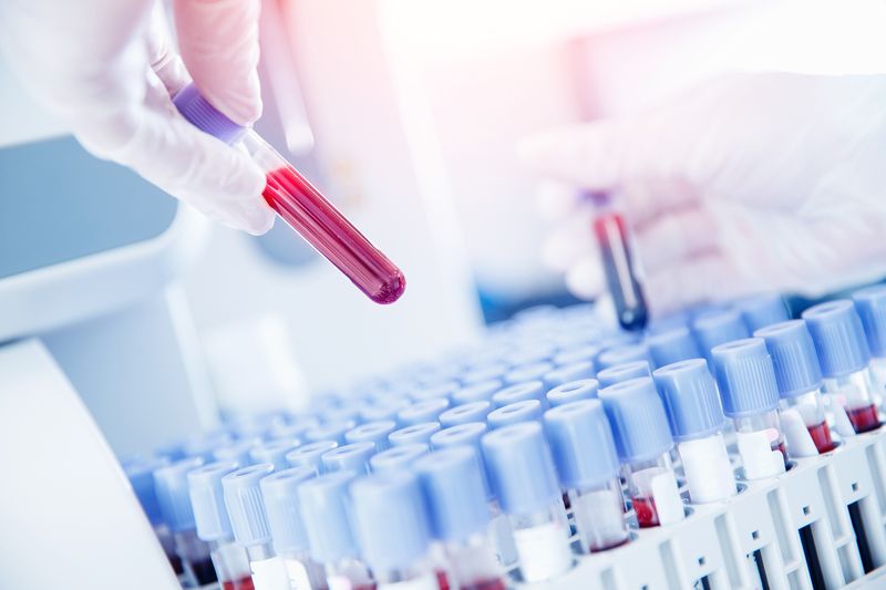 Introduction to blood-based biomarkers - DiviTum® TKa